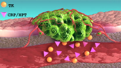 Cancer Monitoring – VDI Laboratory, LLC